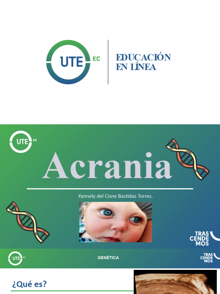 ACRANIA | PDF | Relaciones personales, crianza y desarrollo personal ...