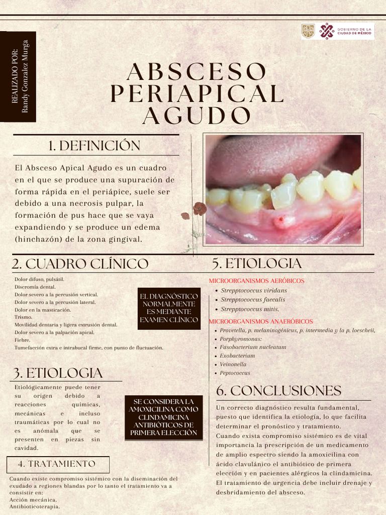 Absceso Apical Agudo Poster | PDF