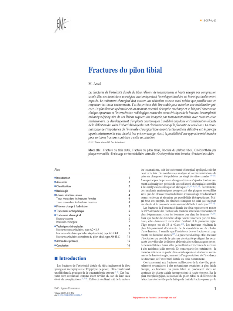 Fractures Du Pilon Tibial | PDF