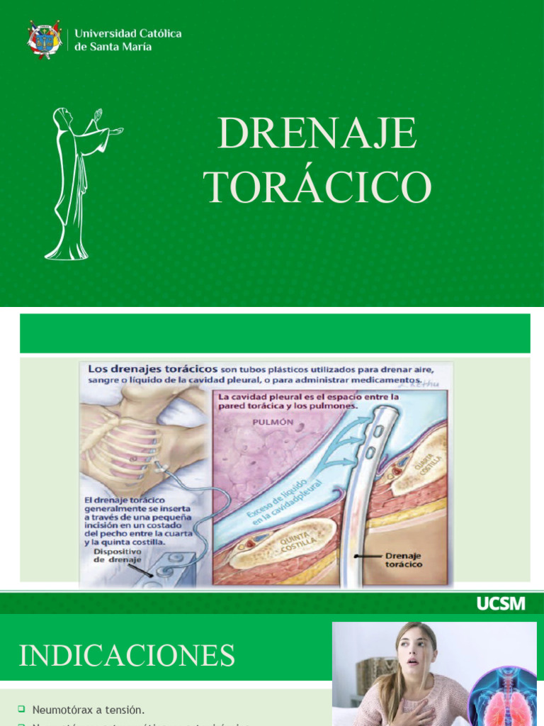 Drenaje Torácico: Indicaciones y Procedimiento | PDF