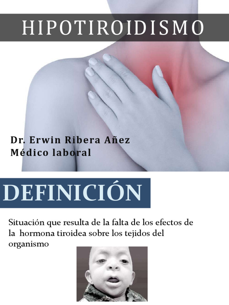 Fisiopatología de la tiroides | PDF | Hipertiroidismo | Hipotiroidismo