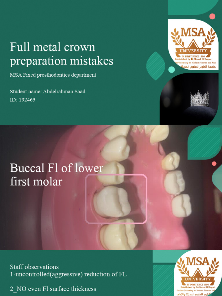Full Metal Crown Preparation Errors | PDF | Career & Growth ...