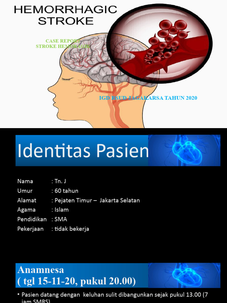 Case Report Stroke | PDF