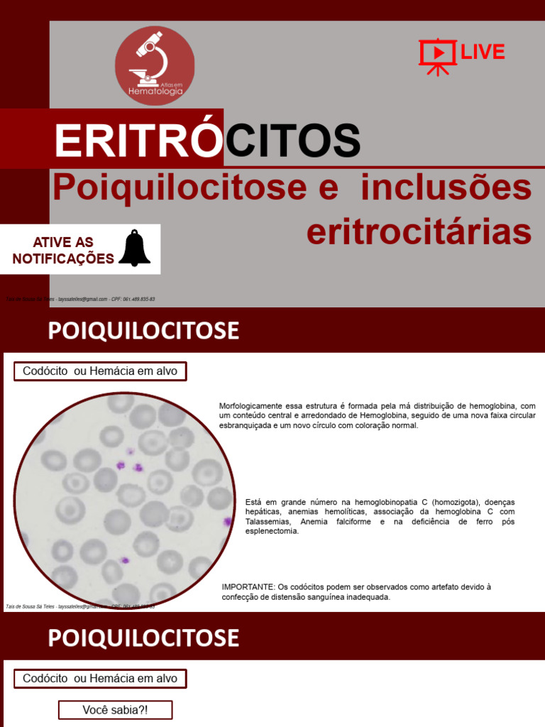 Poiquilocitose e Inclusões Eritrocitárias | PDF