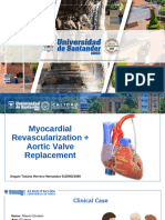 Vascular Plug - Abbott - Amplatzer Vascular Plug | PDF | Interventional ...