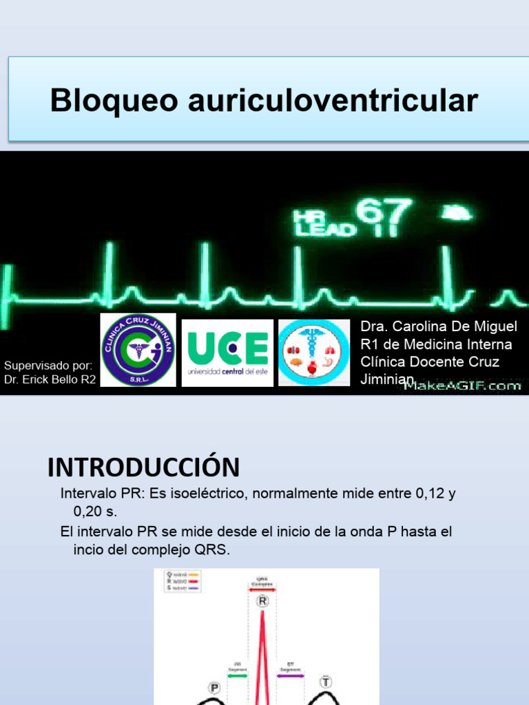 Tipos de Bloqueo Auriculoventricular | PDF | Electrocardiografia ...
