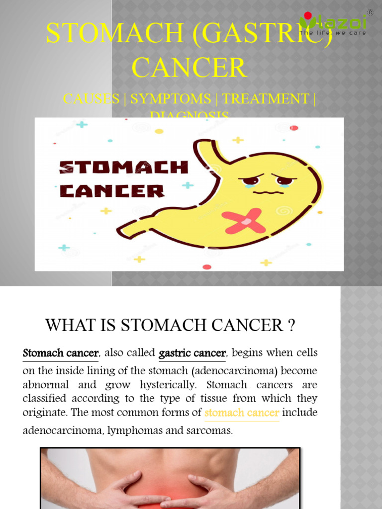 StomachGastricCancer | PDF | Cancer | Gastroenterology