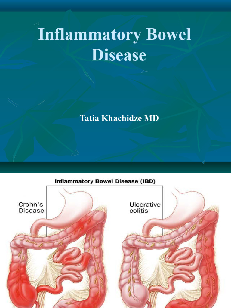 Lecture 2-Part 1 | PDF | Ulcerative Colitis | Crohn's Disease