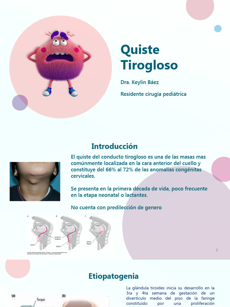 Quiste tirogloso | PDF | Tiroides | Causas de la muerte