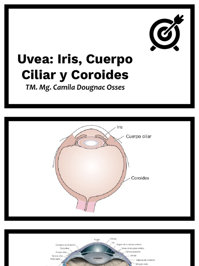 Uvea: Iris, Cuerpo Ciliar y Coroides | PDF | Ojo humano | Glaucoma