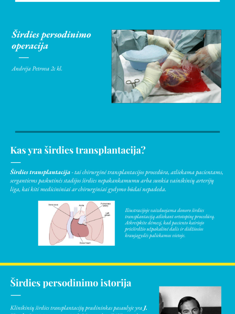 Širdies persodinimo operacija-1 | PDF