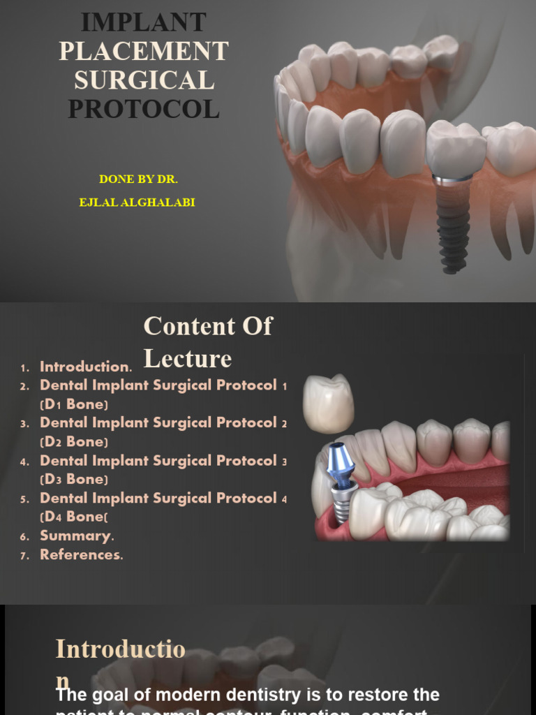 Surgical Phase of Dental Implant Placement | PDF | Dental Implant | Bone