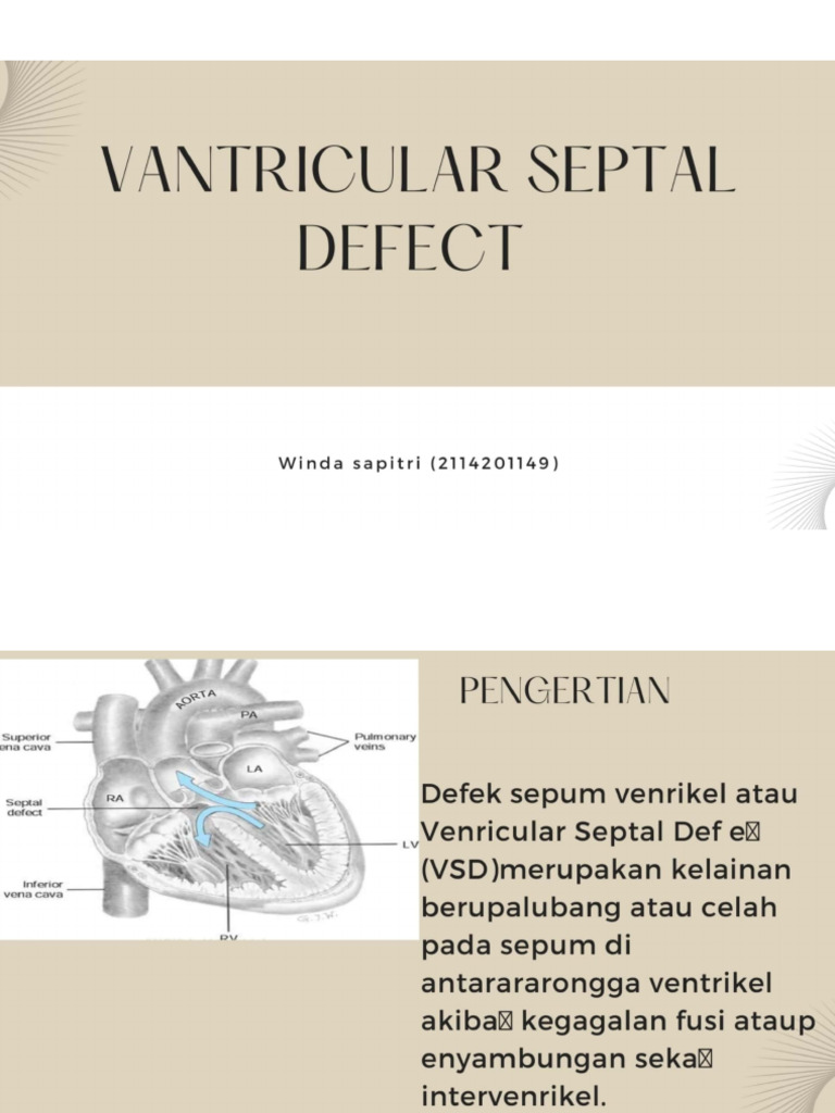 VSD | PDF