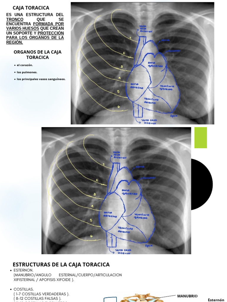 CAJA TORACICA Presentación. | PDF | Tórax | Anatomía