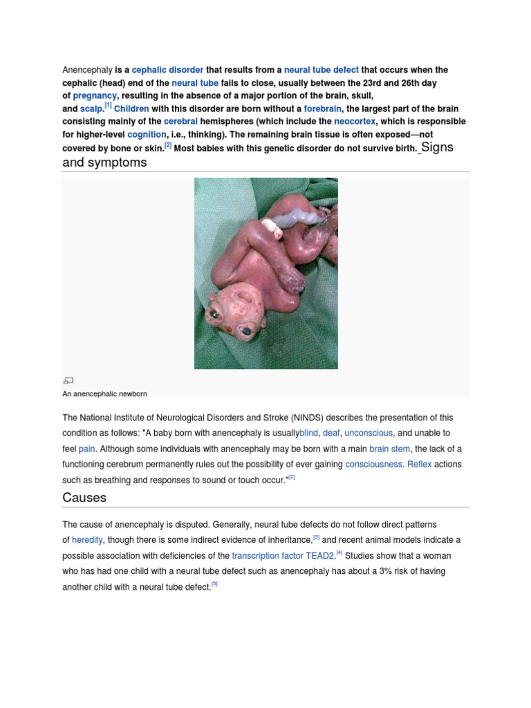 Anencephaly | PDF | Clinical Medicine | Medical Specialties