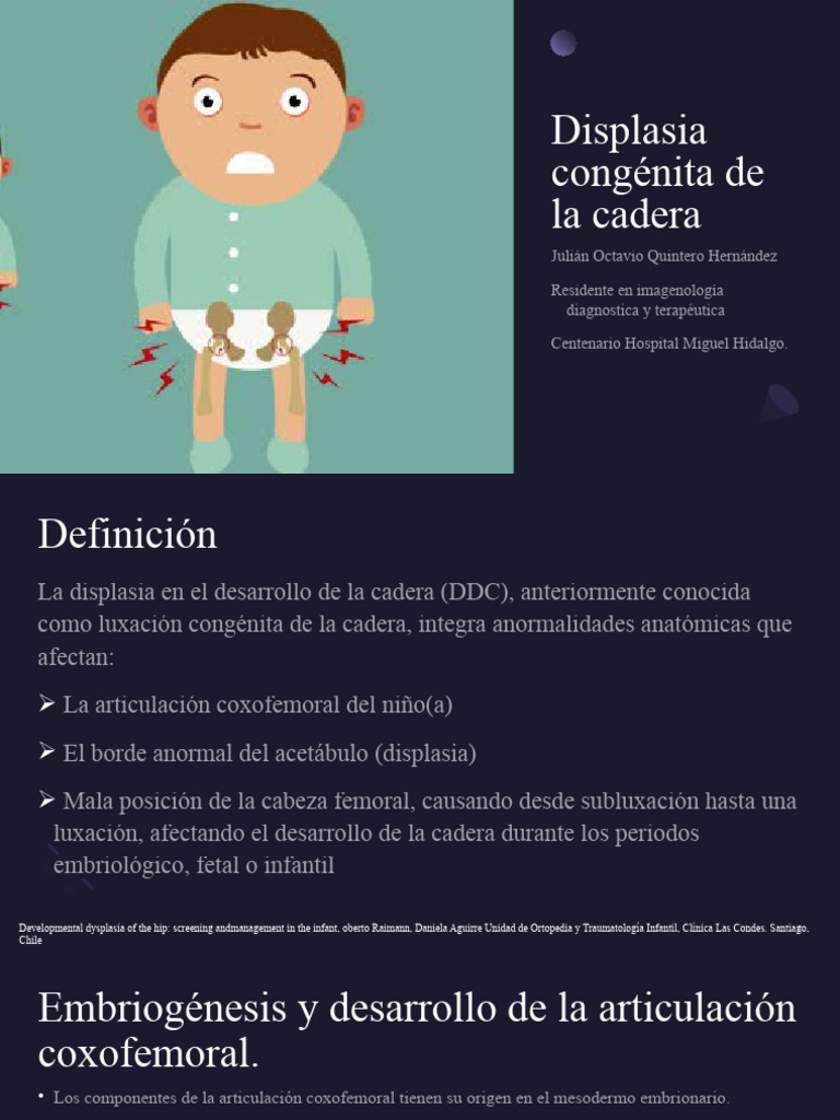 Displasia Congénita de Cadera: Diagnóstico y Tratamiento | PDF ...