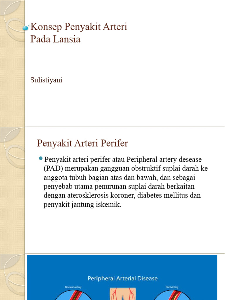 Penyakit Arteri Perifer | PDF