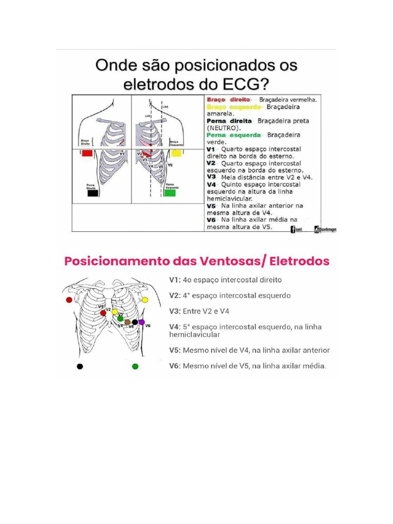 Orientações Posições Ecg | PDF