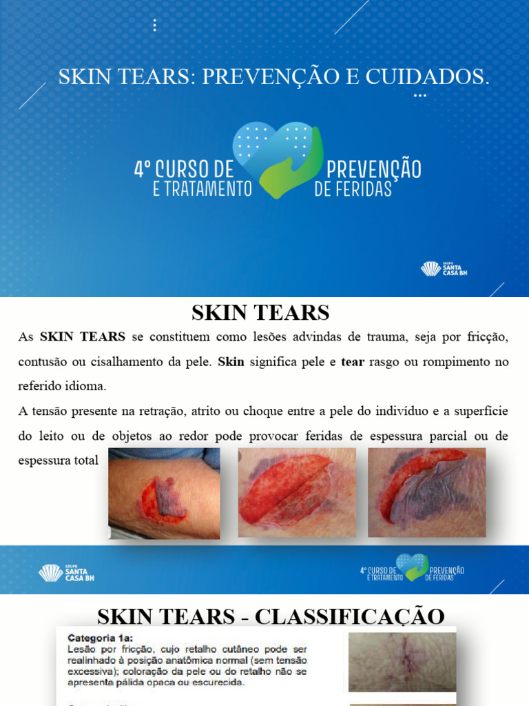Skin Tears: Classificação e Tratamento | PDF