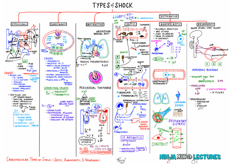 Cardiovascular Physiology) 17 Types of Shock - Septic. Anaphylactic ...