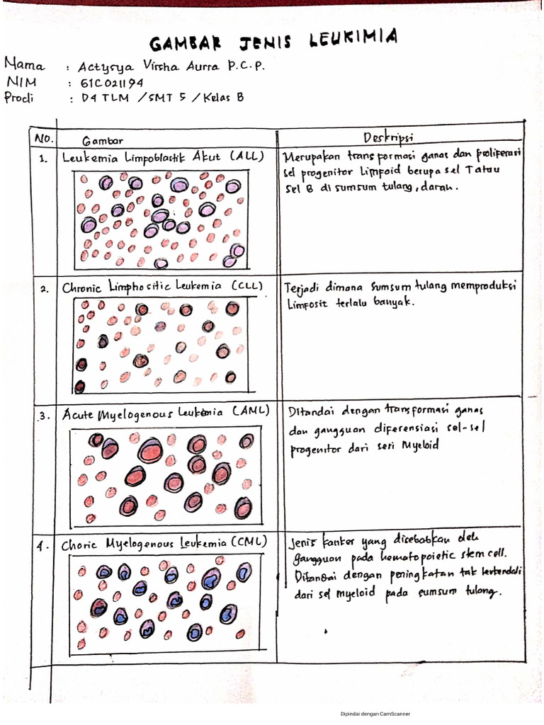 ALL, CLL, AML, Dan CML | PDF