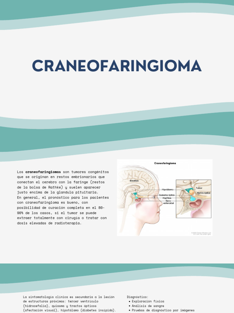 Craneofaringioma: Diagnóstico y Tratamiento | PDF | Salud y bienestar