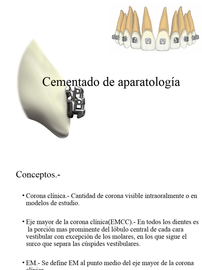Cementado de Aparatología FORT BASICO | PDF | Odontología | Ramas de ...