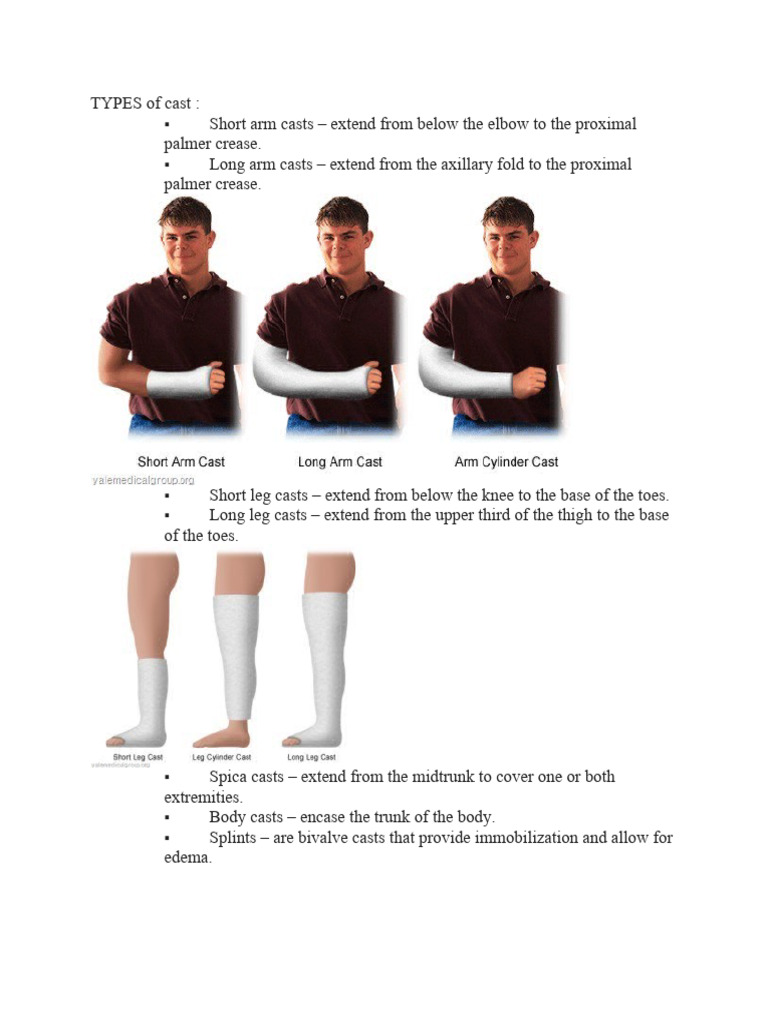 Types of Cast | PDF