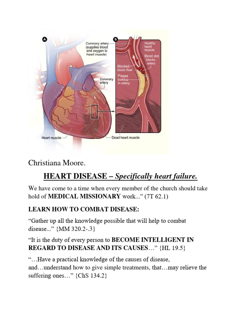 #1HEART DISEASE - Specifically Heart Failure.#1 | PDF | Heart ...