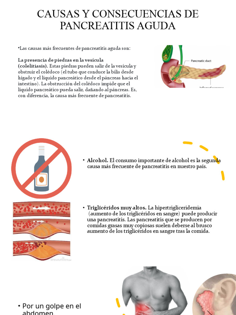 Causas y Consecuencias de Pancreatitis Aguda | PDF