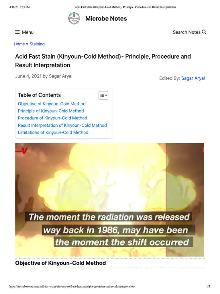 Acid Fast Stain (Kinyoun-Cold Method) - ... E, Procedure and Result ...