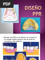 Doble Barra Lingual en Prótesis Removible | PDF | Dentadura postiza ...