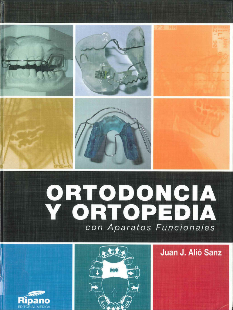 Ortodoncia y Ortopedia Con Aparatos Funcionales-Alio-1ed | PDF