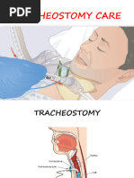 Procedural Checklist For Care of Tracheostomy | PDF | Hand Washing