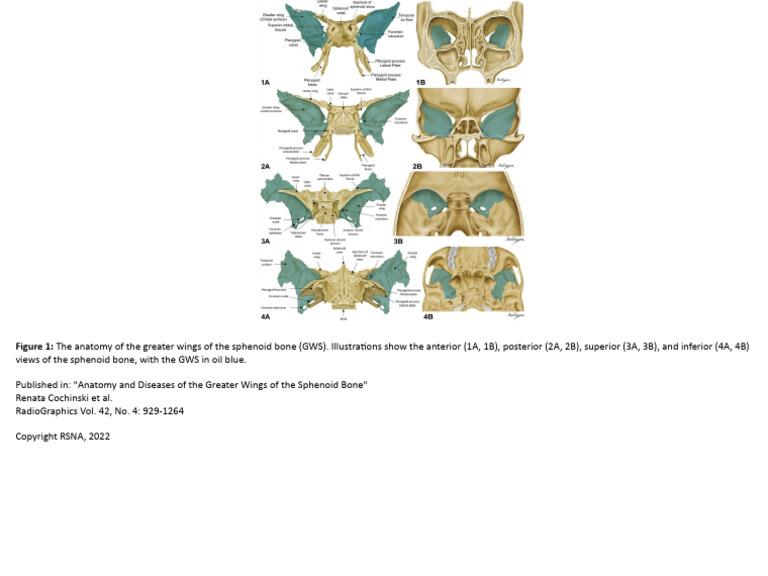 Sphenoid Bone | PDF