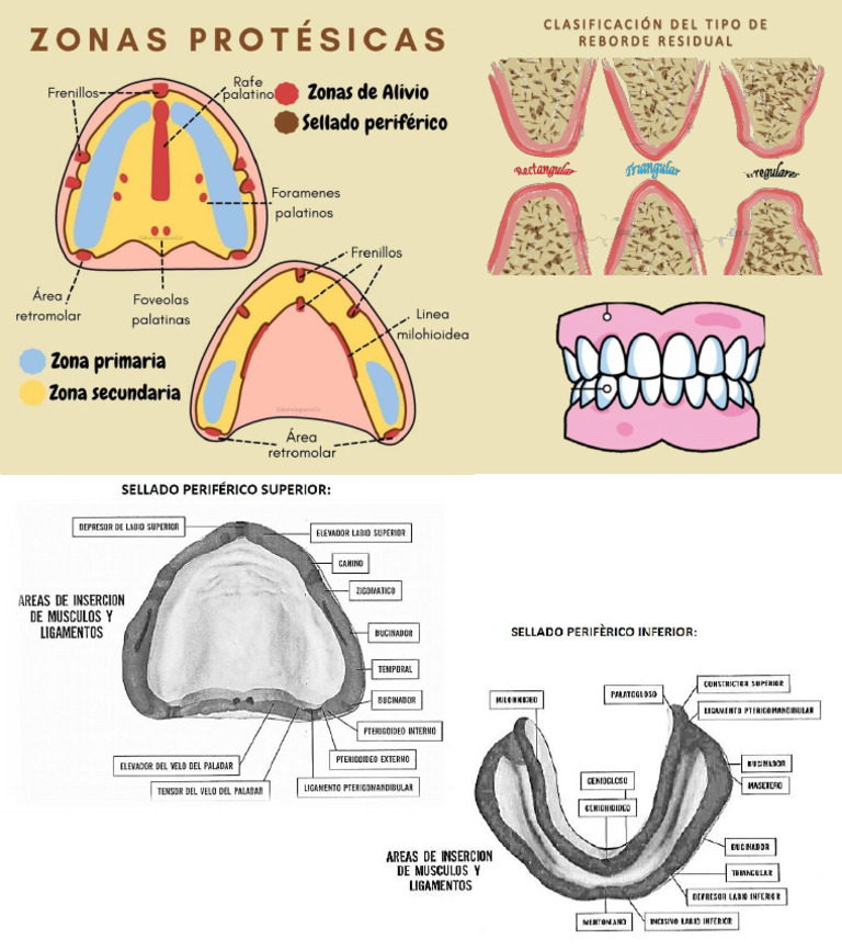 Infografia protesis total | PDF