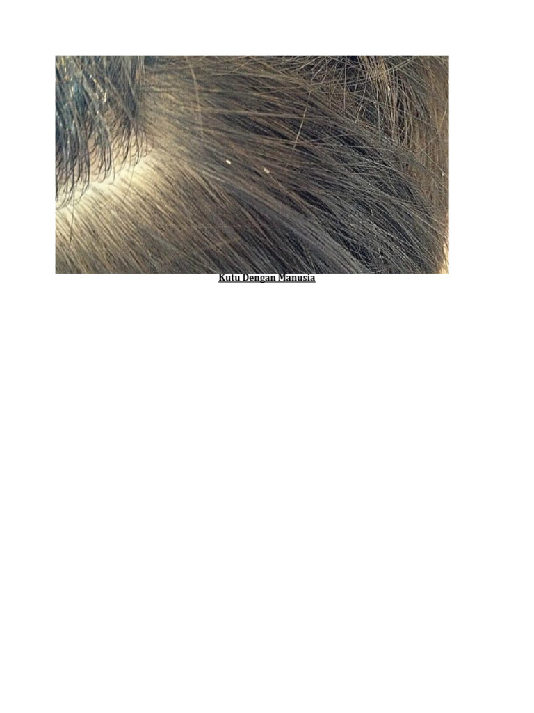 Kutu Dengan Manusia | PDF