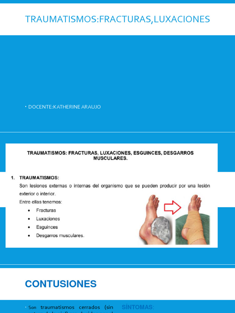 TRAUMATISMO | PDF | Lesión | Traumatologia