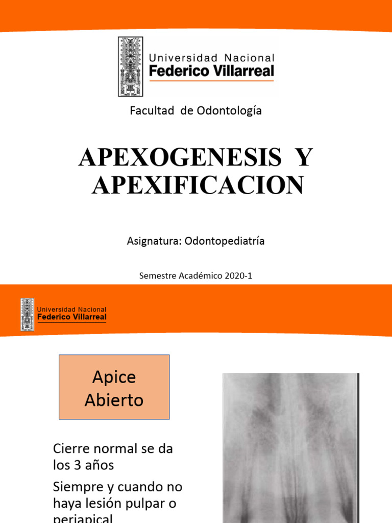 Apicogenesis | PDF | Medicina CLINICA | Especialidades Medicas