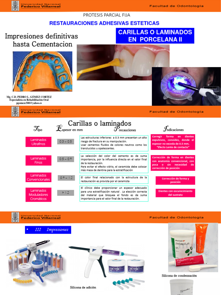 22P Carilla en Porcelana II Practica | PDF | Dentadura postiza | Materiales