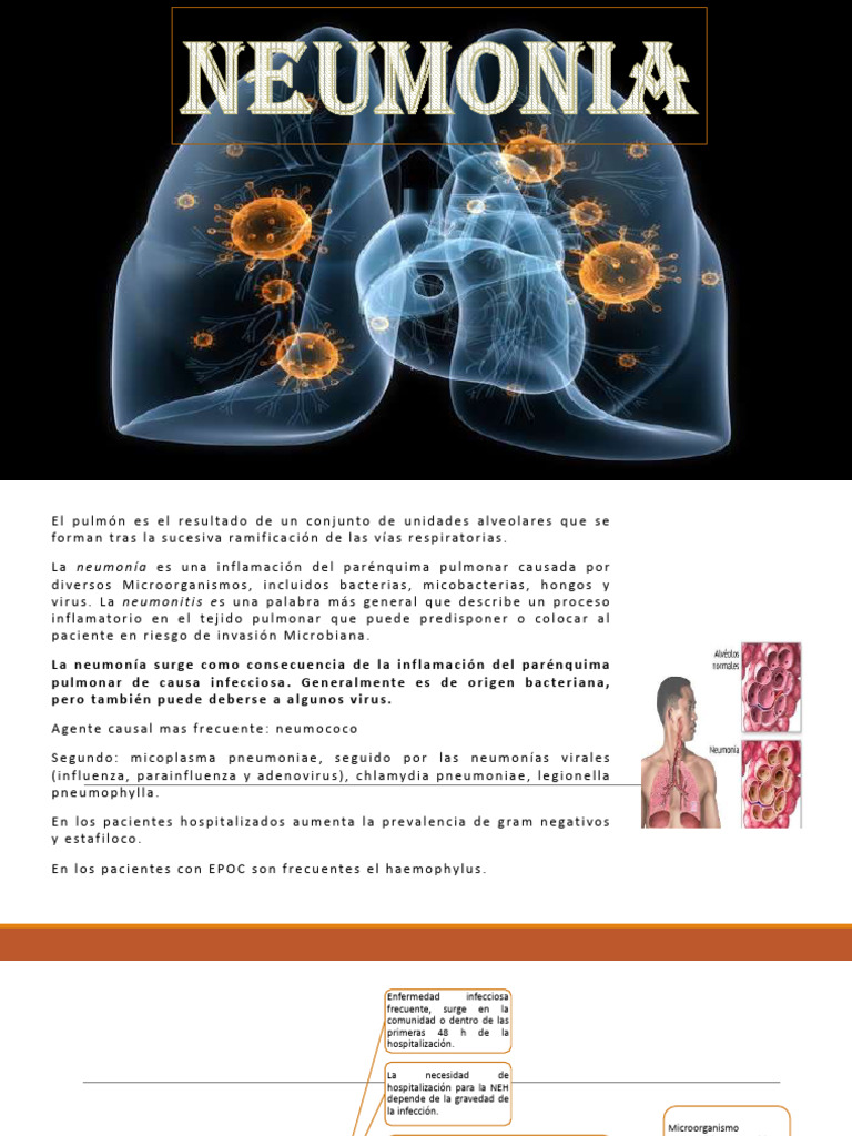 Neumonía | PDF