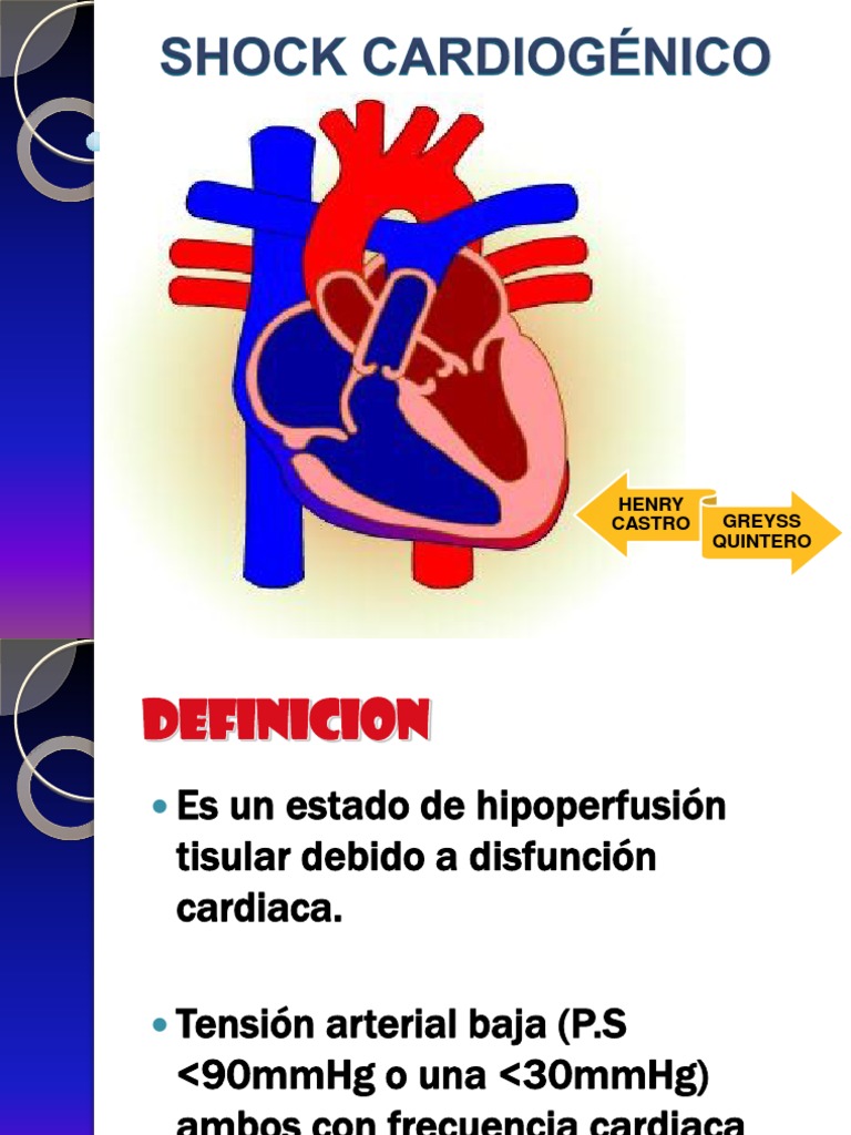 Shock Cardiogenico | Infarto de miocardio | Choque (circulatorio)