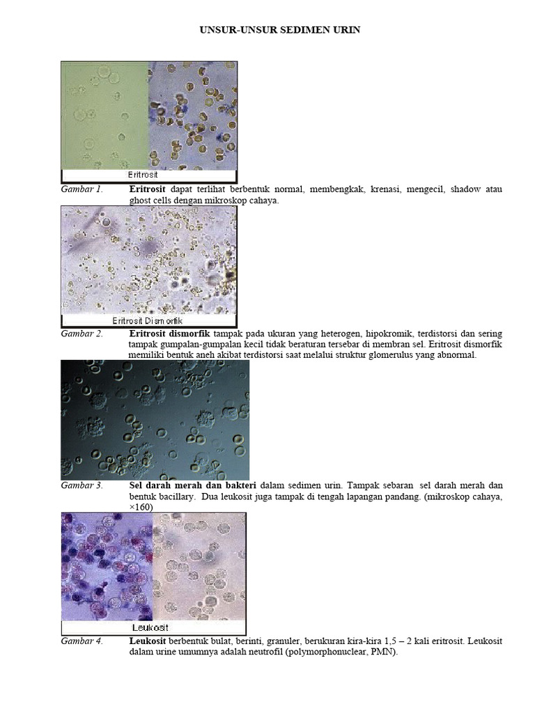 Unsur Unsur Sedimen Urin | PDF