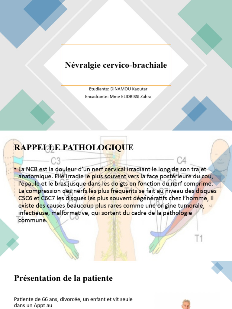 Névralgie Cervico-Brachiale: Etudiante: DINAMOU Kaoutar Encadrante: Mme ...