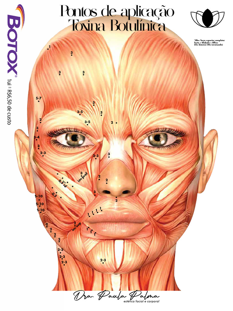 Pontos de Botox 2 | PDF