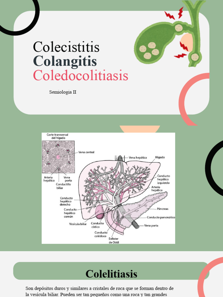 Colecistitis, Coledocolitiasis y Colangitis | PDF