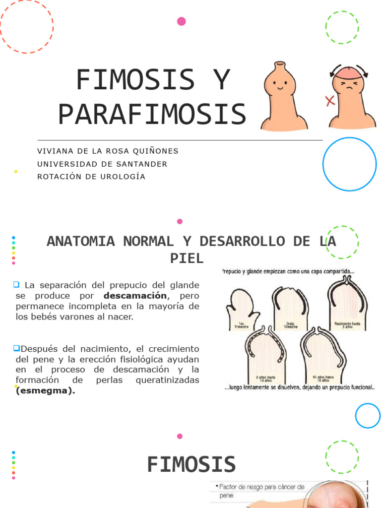 Fimosis y Parafimosis | PDF
