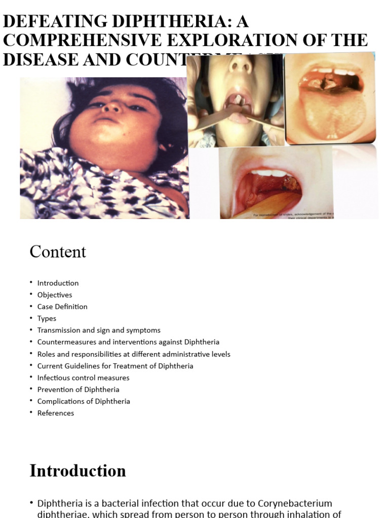 Diphtheria Presentation | PDF | Wellness | Science & Mathematics
