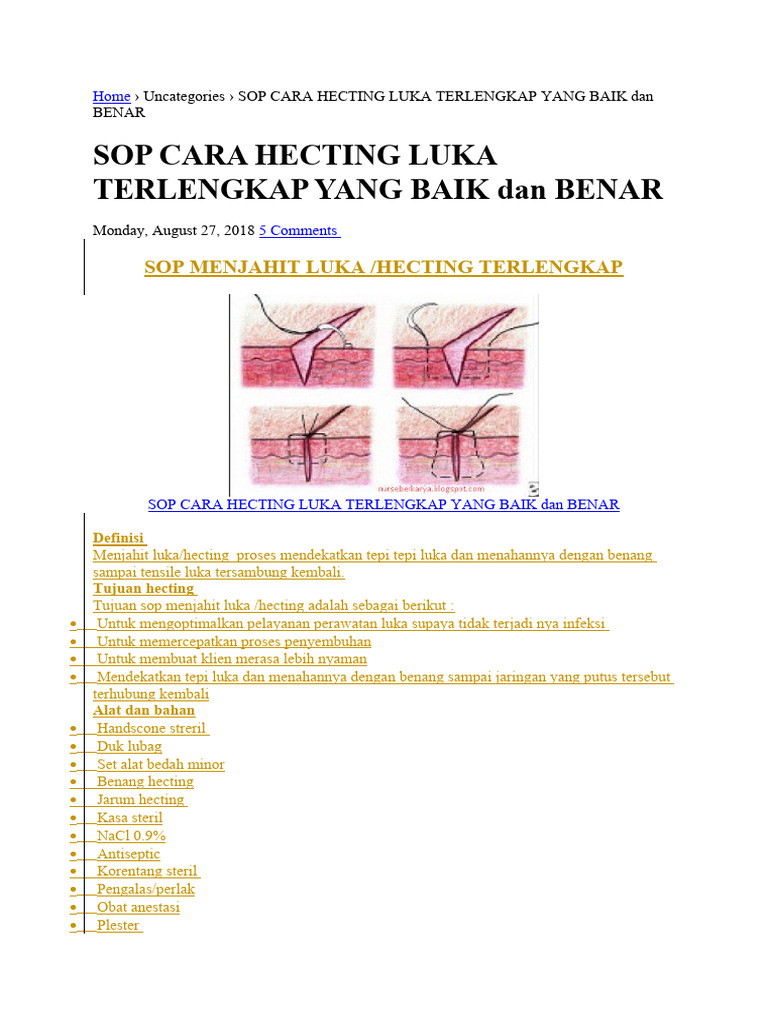 Sop Hecting | PDF
