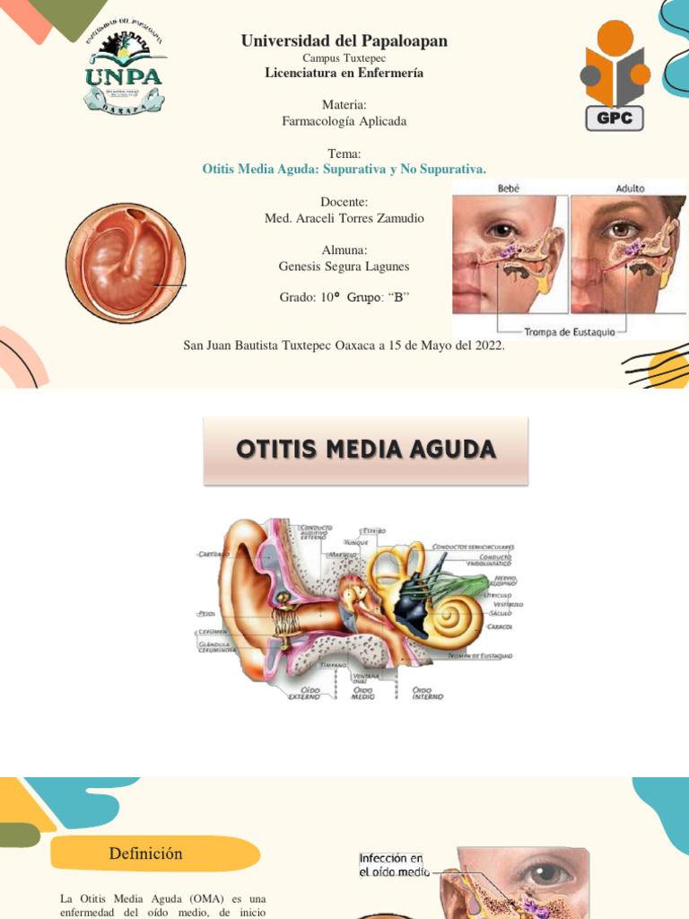 Otitis Media Aguda | PDF